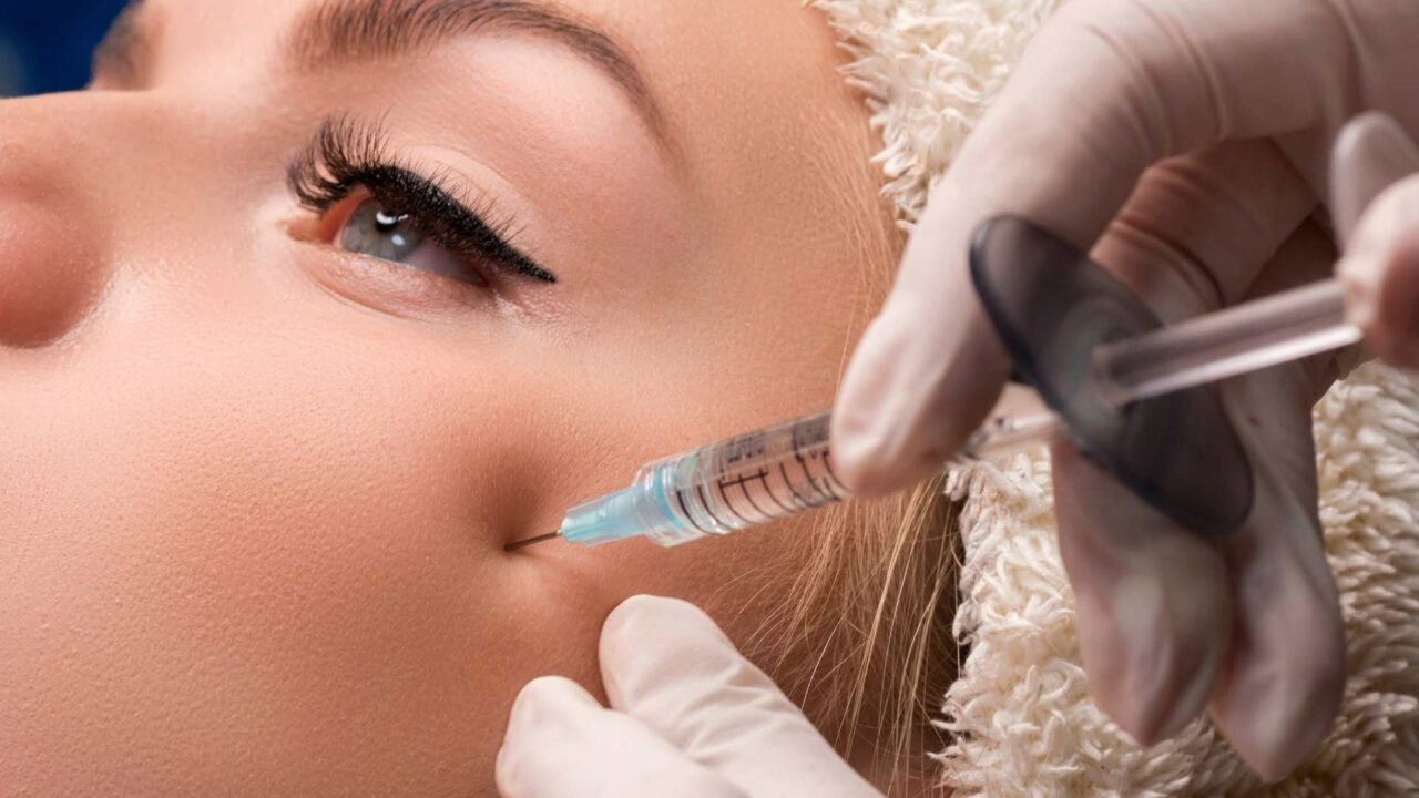 Injections des pommettes : des retours positifs